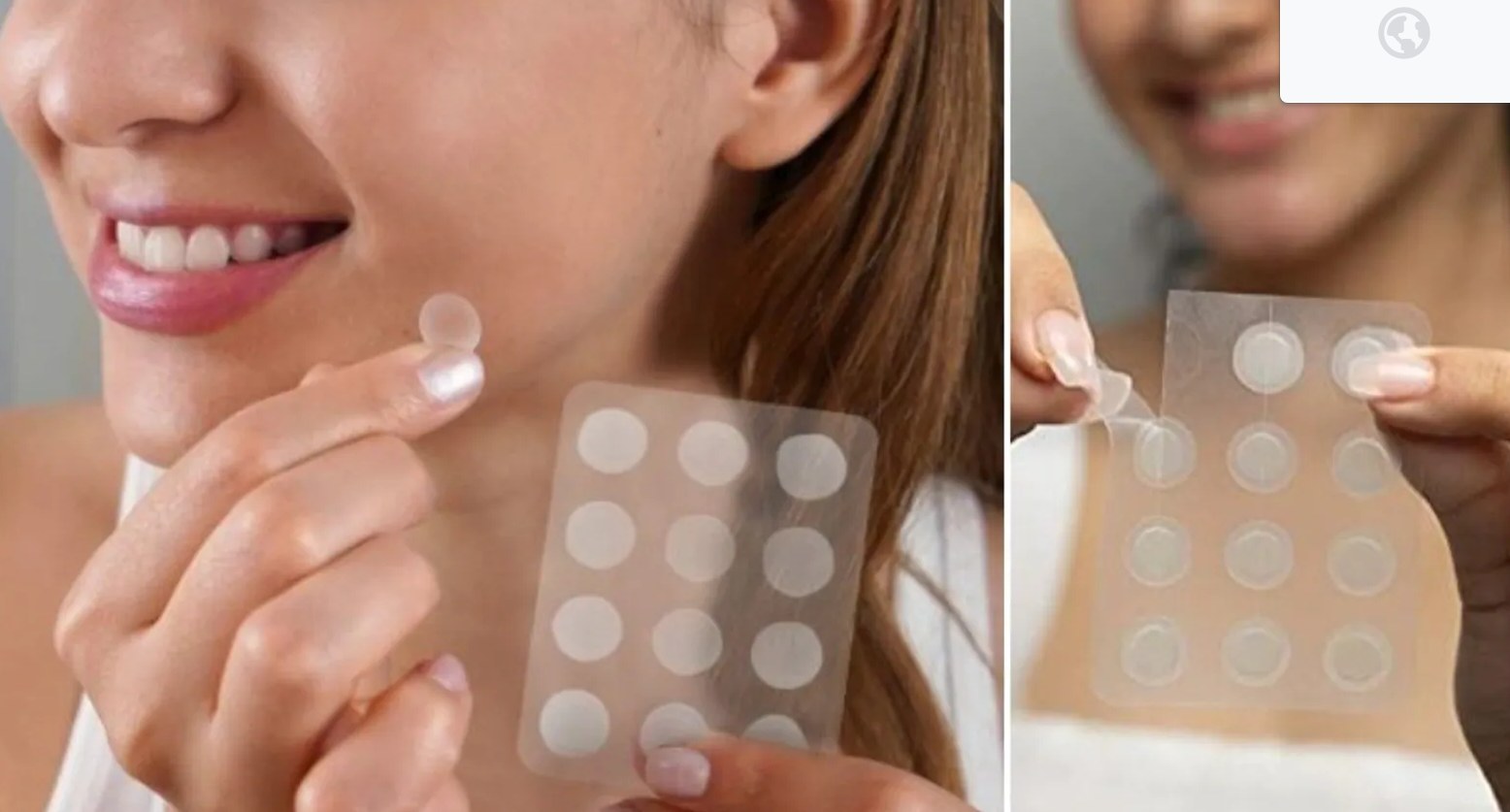 Best pimple patches of 2023, Acne Patches